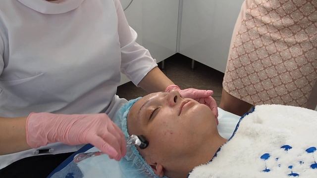 Мезопилинг фракционно и мануально (Часть 2)