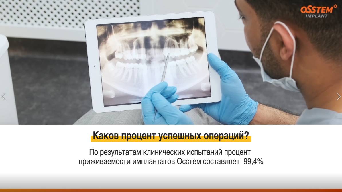 Вопросы пациентов об имплантации