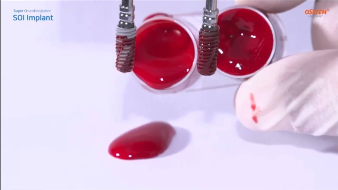 Новые имплантаты TSIII SOI