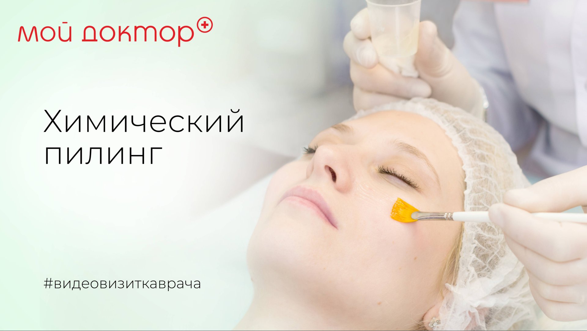 Химический пилинг