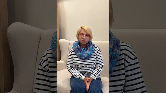 ОТЗЫВ ПОСЛЕ СМАС-ПОДТЯЖКИ ЛИЦА И ШЕИ. Доктор Карапетян