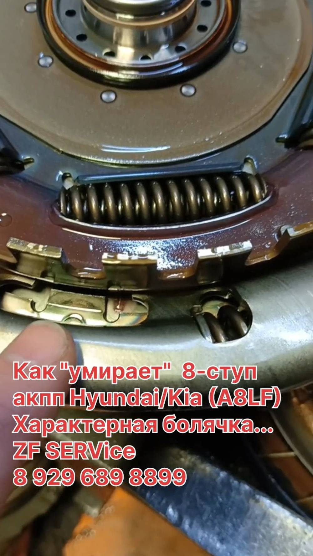 Как _умирает_  8-ступ. акпп Hyundai_Kia (A8LF). Характерная болячка ...