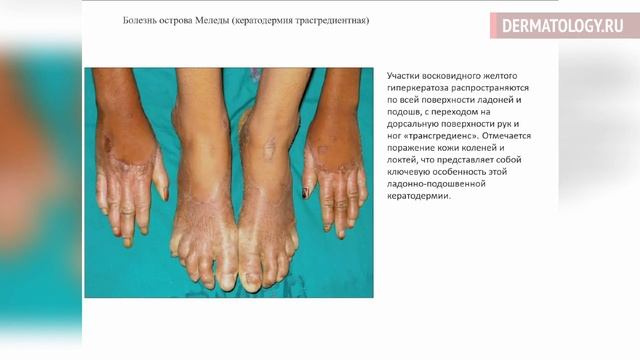 Телемост на тему: «Витамины ADE»