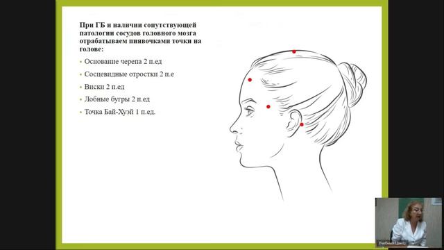 Гирудотерапия при инфарктах и инсультах. Фрагмент вебинара