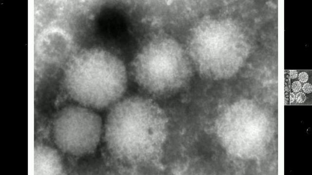 В Японии зарегистрировали случаи заражения ранее неизвестным ортонайровирусом Йезо