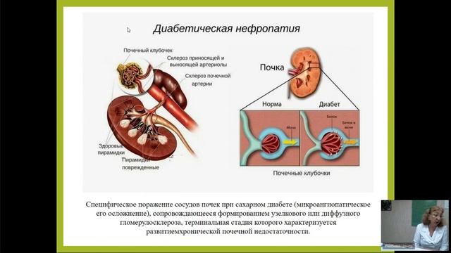 Гирудотерапия в лечении сахарного диабета и его осложнений. Фрагмент вебинара