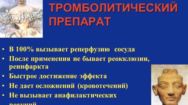 Лечение инфаркта миокарда часть 2 Кошкина Е. В.