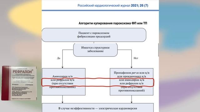 Аритмии и Рефралон Кошкина Е.В. 2023