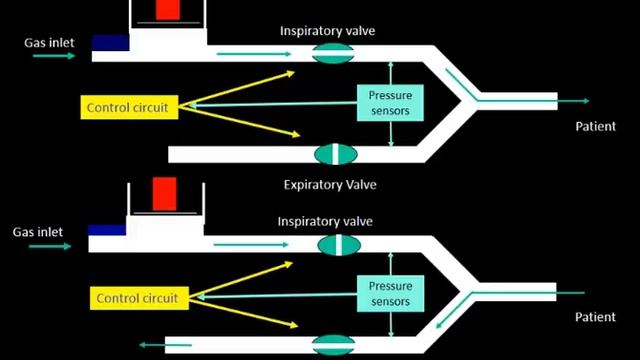 The principles of Controlled mechanical ventilation Bellani Giacomo 2018