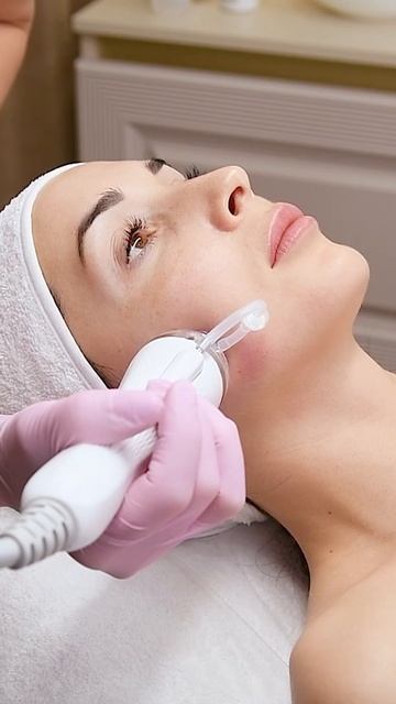 Проведение процедуры. Игольчатый РФ лифтинг. ЭСМА микроигольчатый радиочастотный лифтинг.