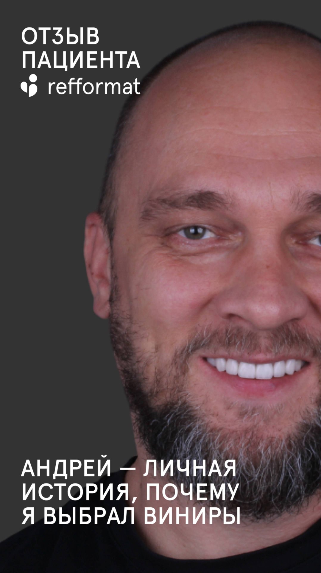 Почему я выбрал виниры: личная история