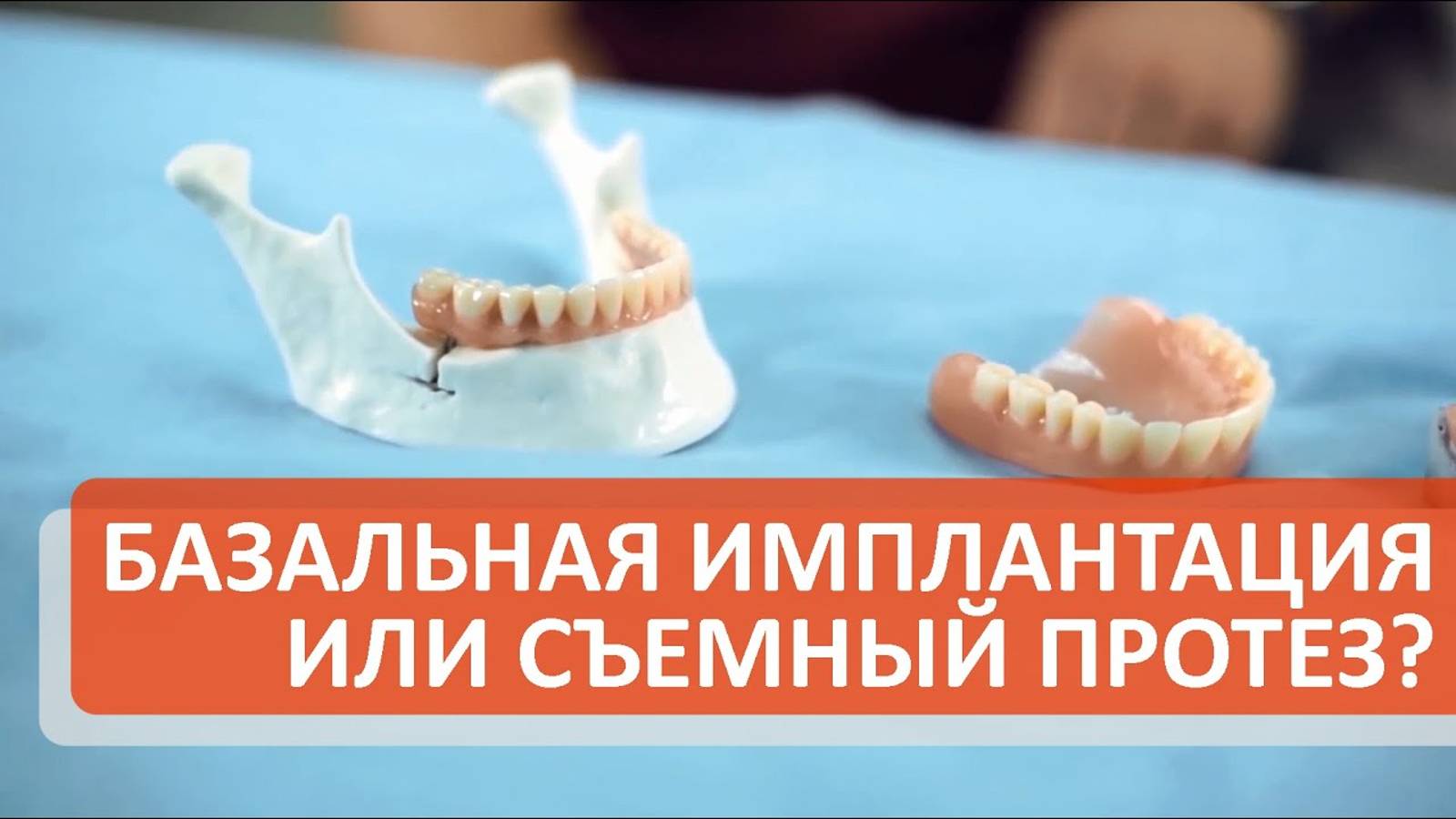 Преимущества базальной имплантации зубов по сравнению со съемным протезированием. Симпладент.