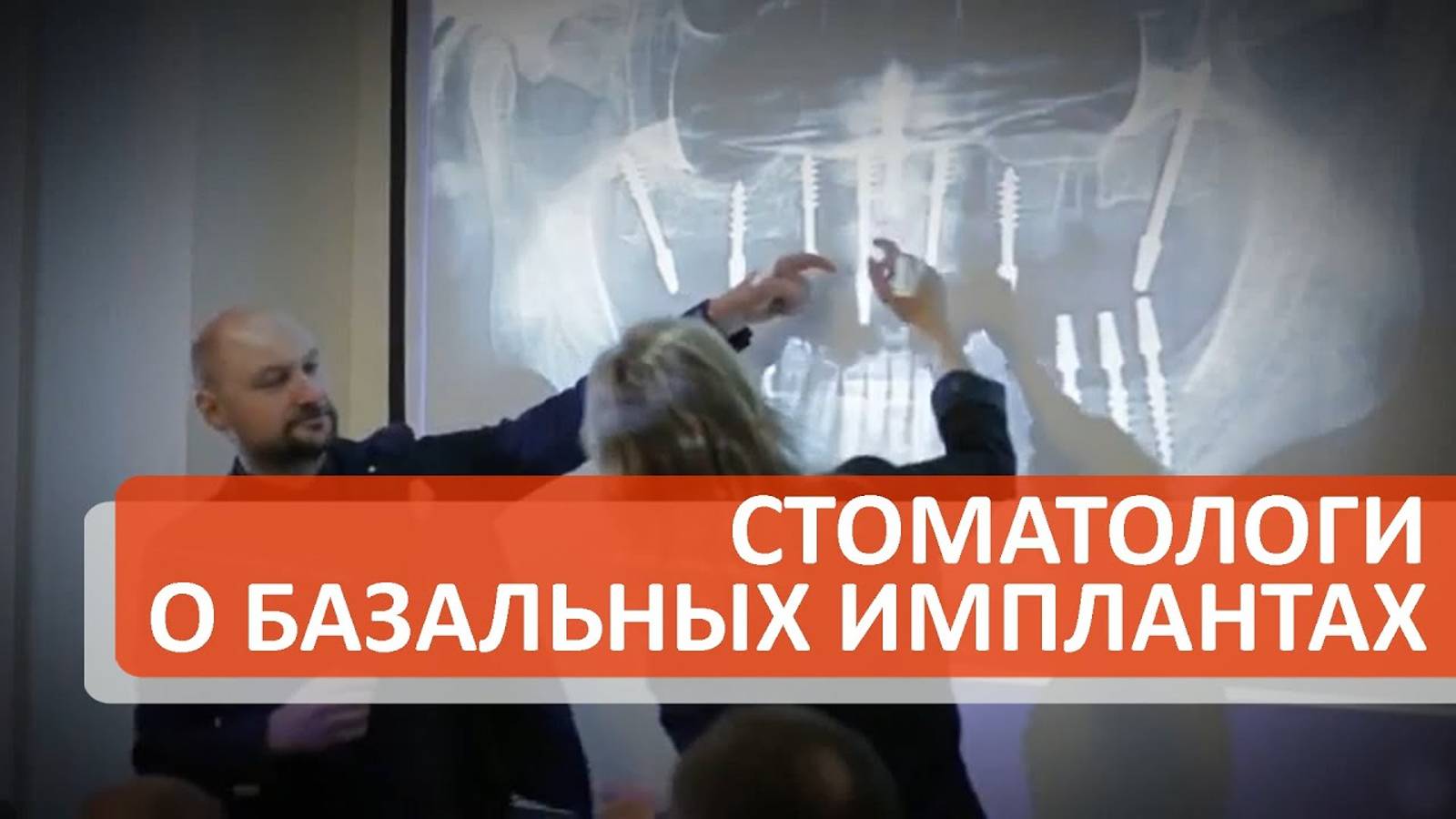 Чтo думaют врaчи о базальной имплaнтaции зубов ROOTT? Мнение стоматологов. Simpladent. Симпладент.