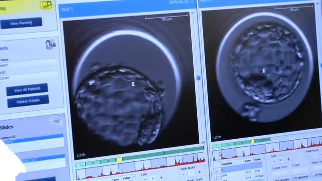 We owe it to our patients to use time lapse