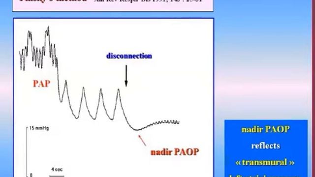 4  Cardiac Fillig pressures vs end diast volumes Teboul J L  (2009)