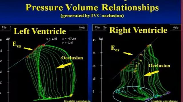 5   Right Ventr Funktion under pressure Pinsky M  (2009)
