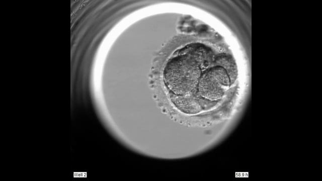 Развитие эмбриона до стадии бластоцисты. Видео из time-lapse системы EmbryoScope