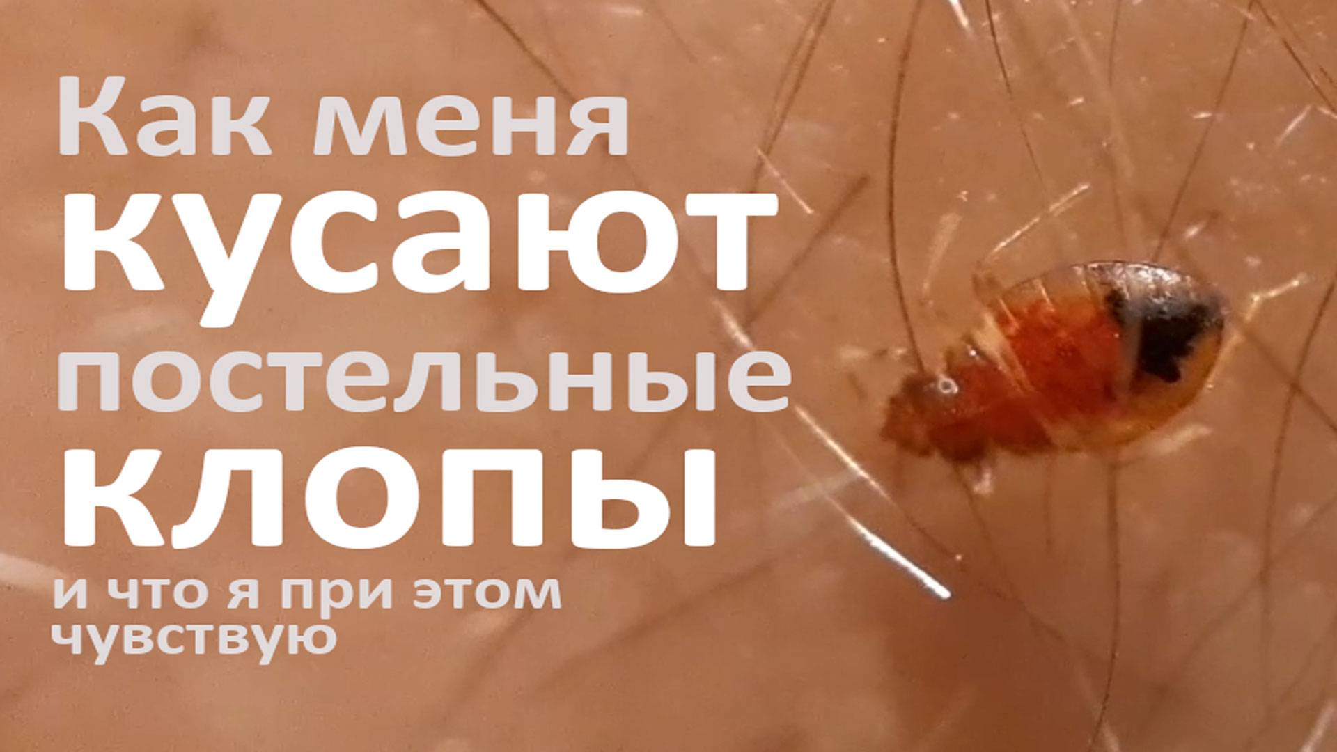 Как меня кусают постельные клопы — взрослые и личинки, и что я при этом чувствую
