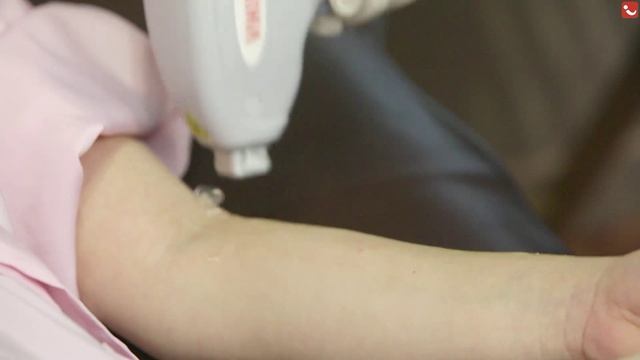 VIKINI - Поэтапное проведение процедуры