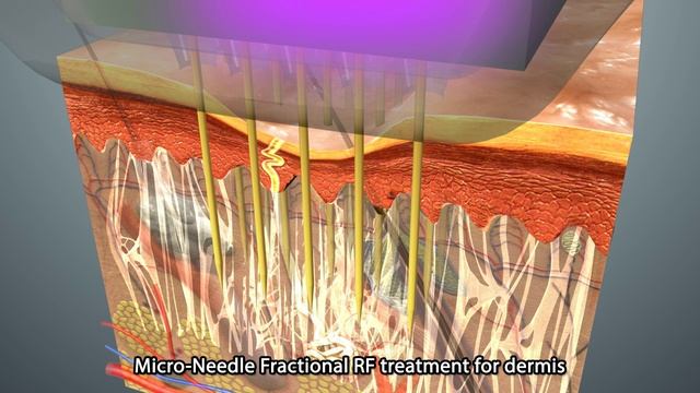 FRAXIS DUO ANIMATION By ILOODA