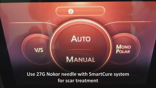 Электроручка SmartCure. Метод термокоагуляции.