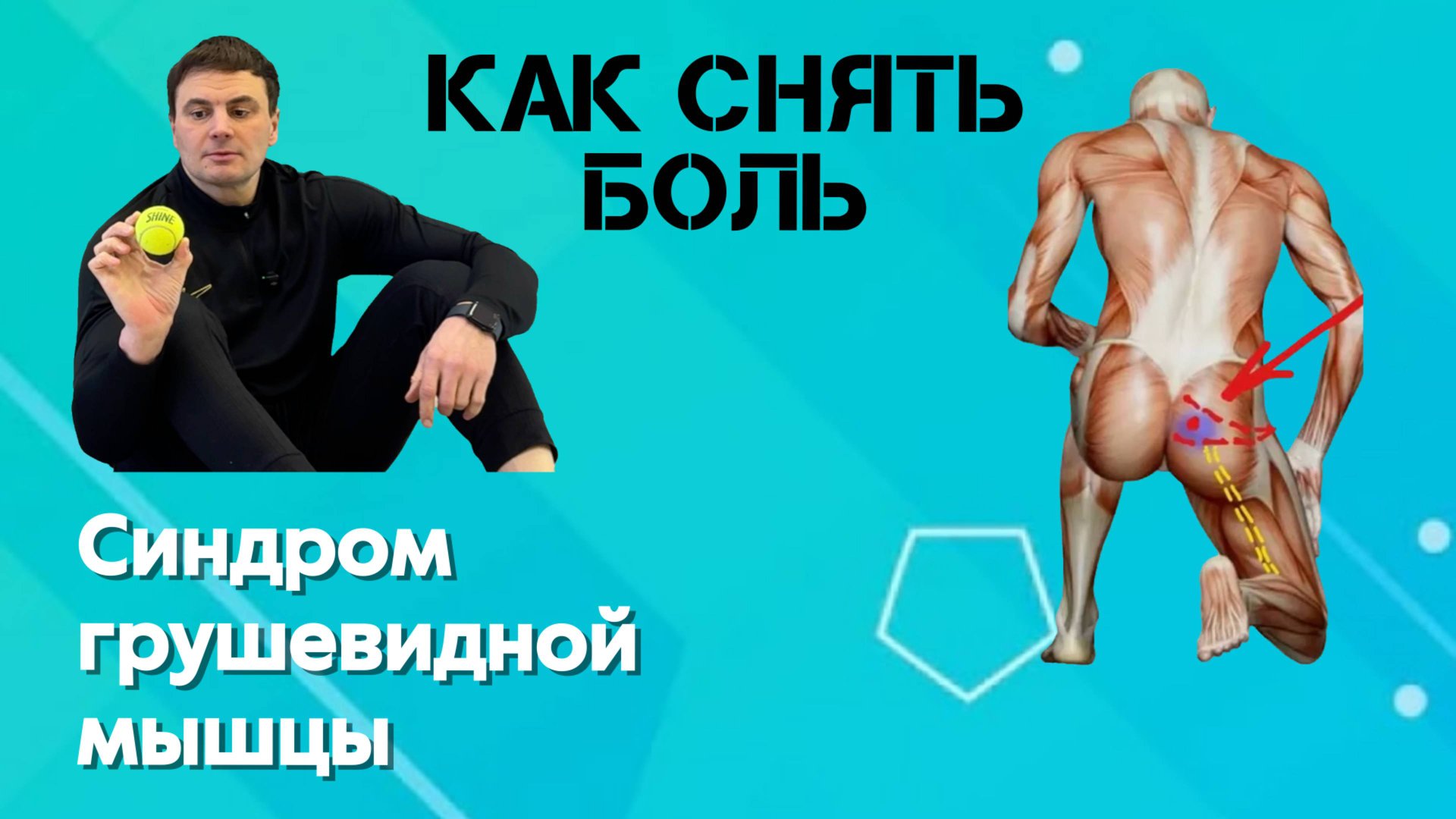 Синдром грушевидной мышцы, боль в ноге. Как снять напряжение и боль через мфр мячик. Подробно.