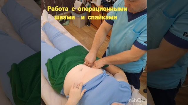 Работа с операционными швами и спайками.