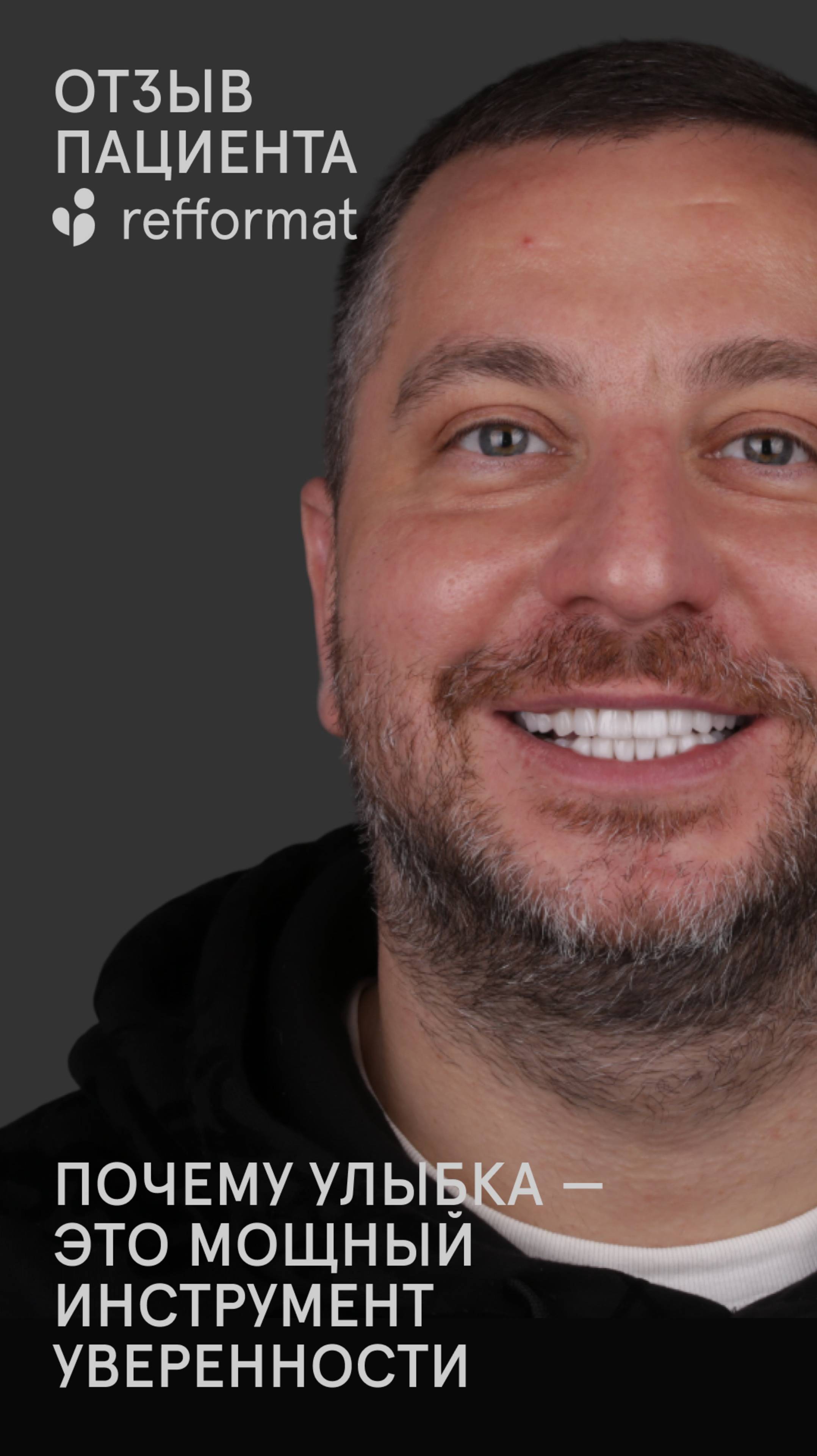 Почему улыбка — мощный инструмент для уверенности