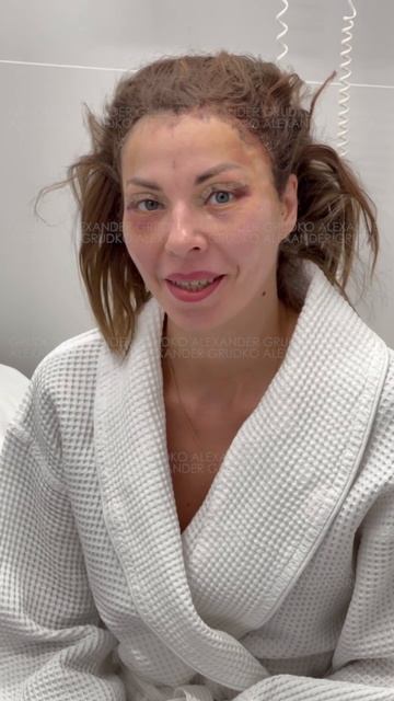 Сутки после подтяжки бровей и век