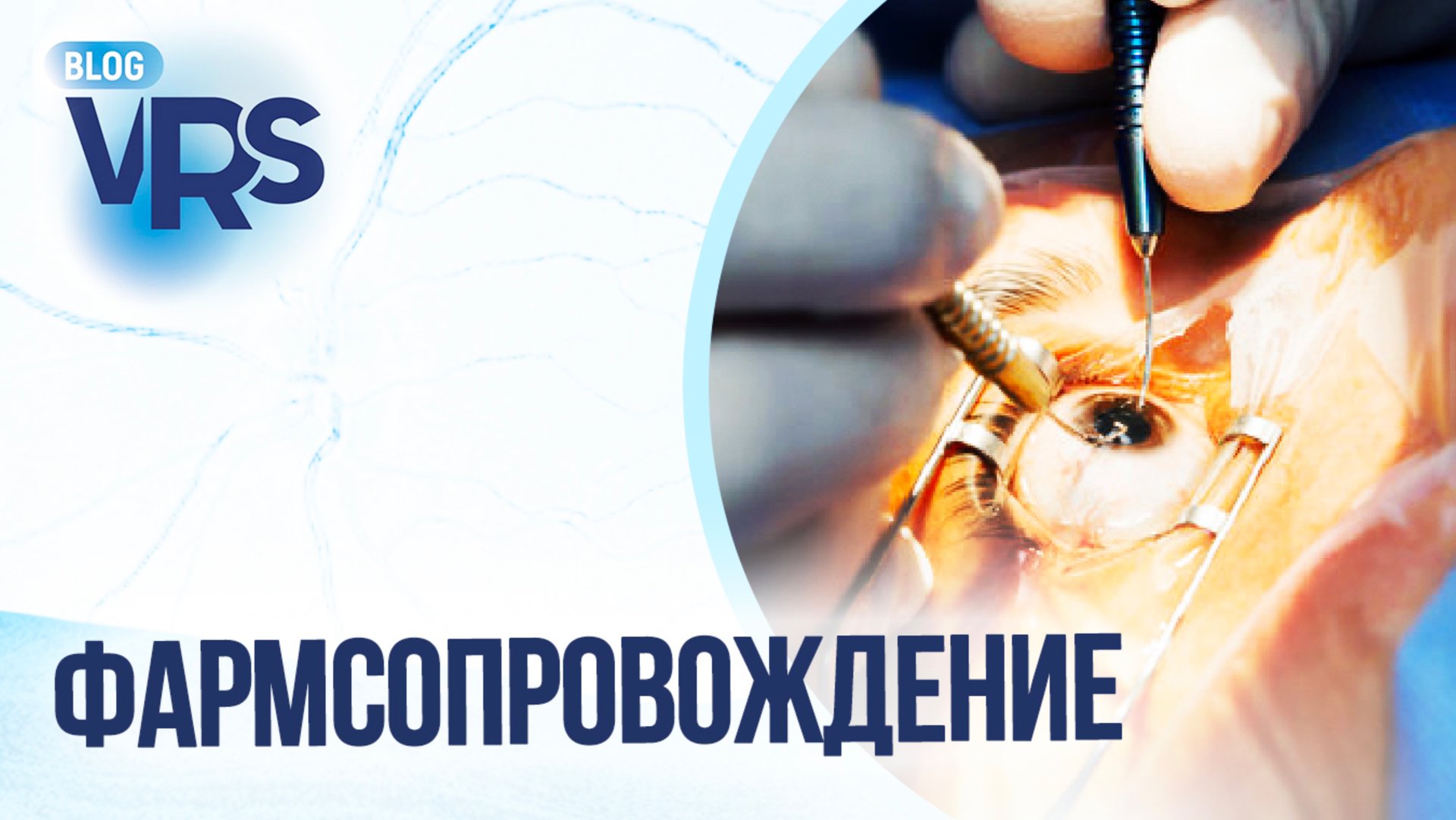 Хирургия катаракты / Фармакологическое сопровождение