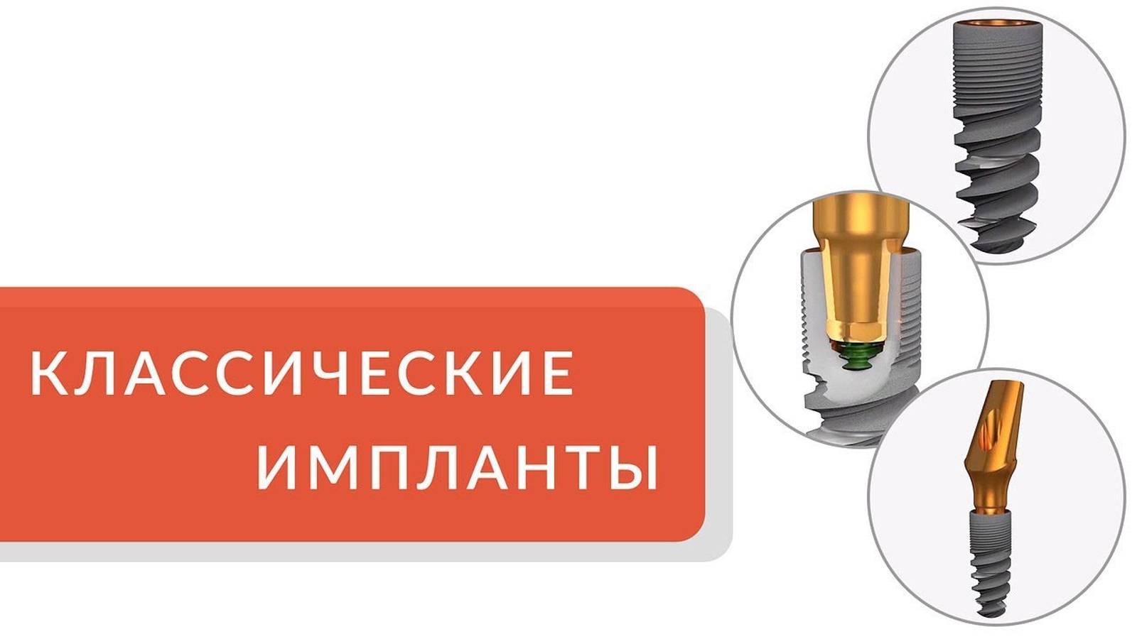 ROOTT импланты. ☝ Преимущества классических имплантов системы ROOTT. 12+