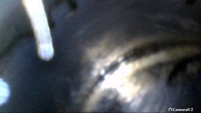 Эндоскопия