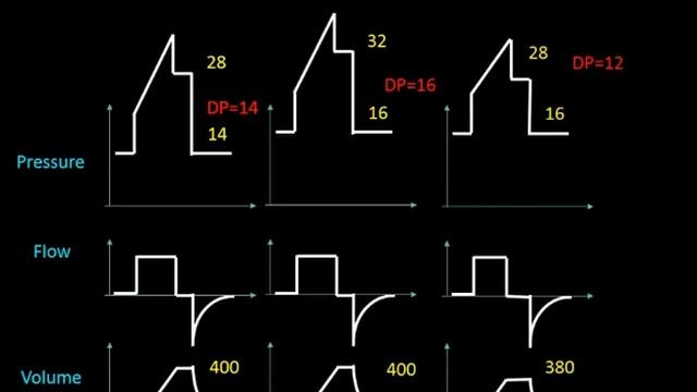 ARDS case based discussion Bellani Giacomo 2018