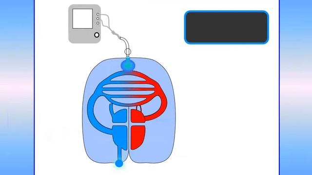 Assessment of fluid responsiveness. Teboul Jean-Louis
