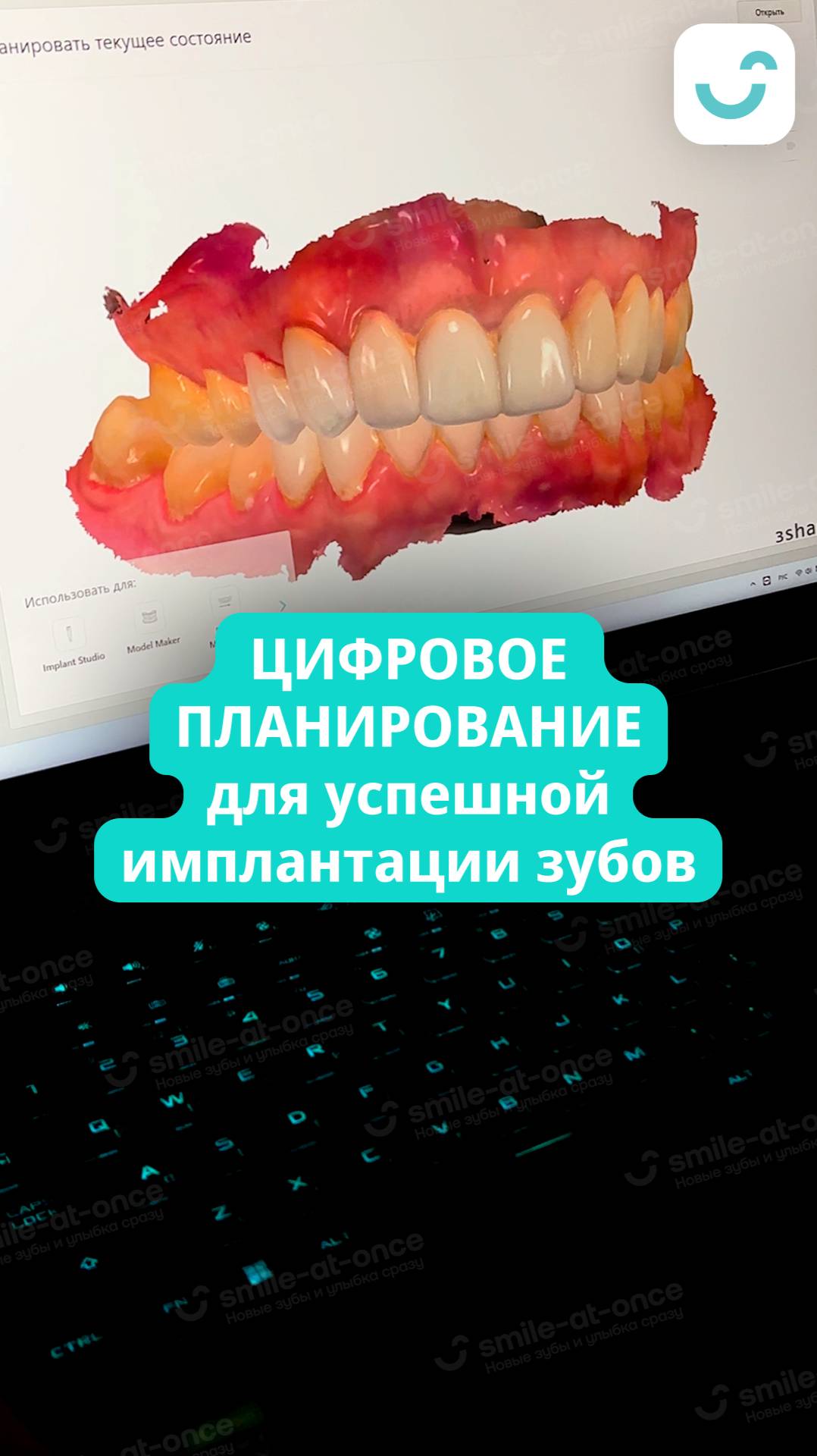 3D-планирование имплантации зубов: ваше здоровье – наш главный приоритет!