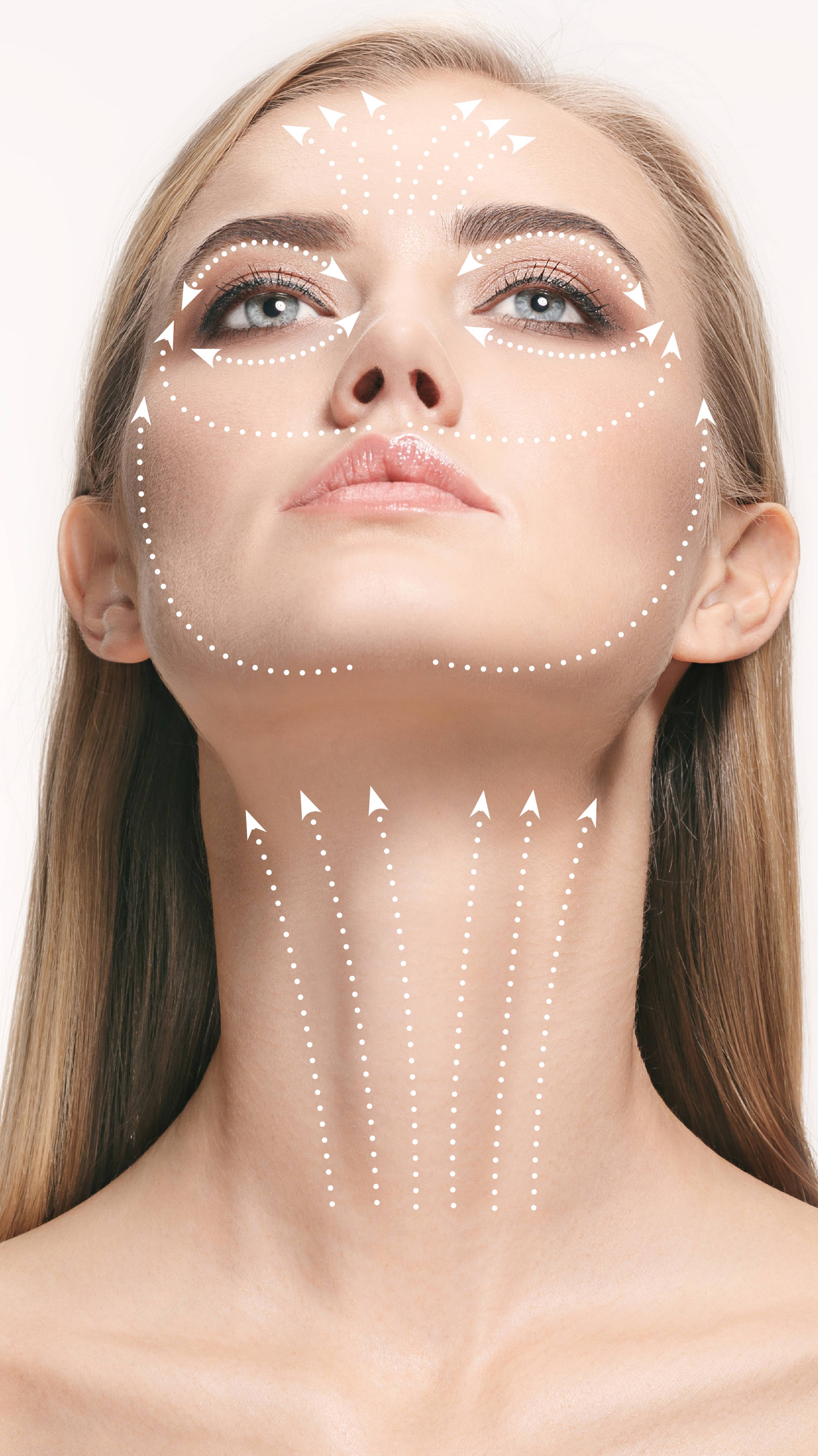 Секреты нитевого лифтинга