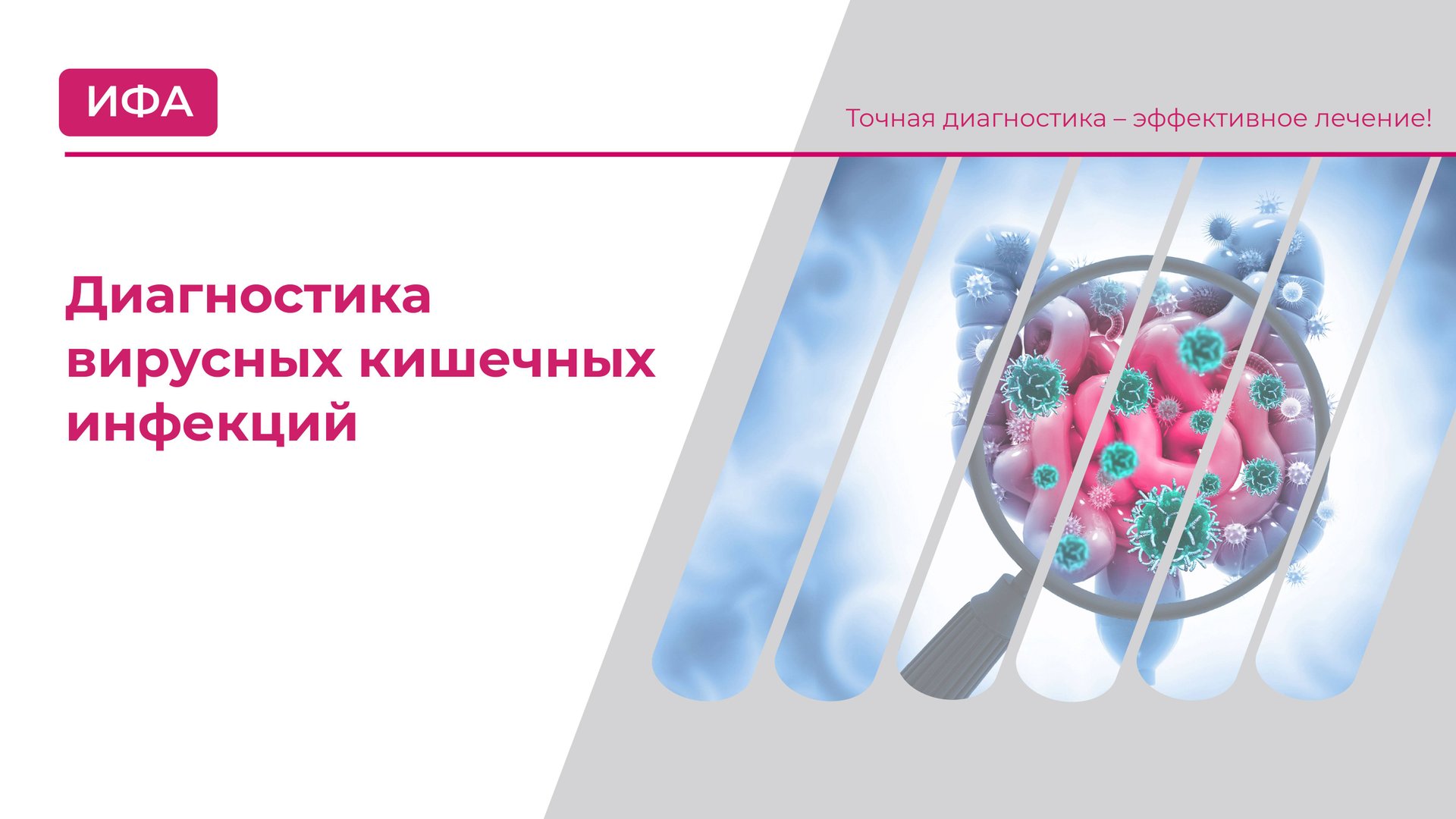 Диагностика ОКИ вирусной этиологии