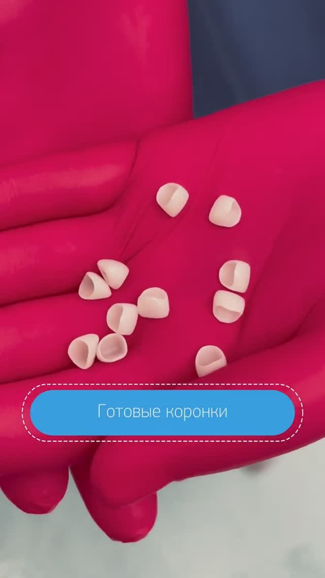 Коронки на молочные зубы от Дентал Фэнтези Lab