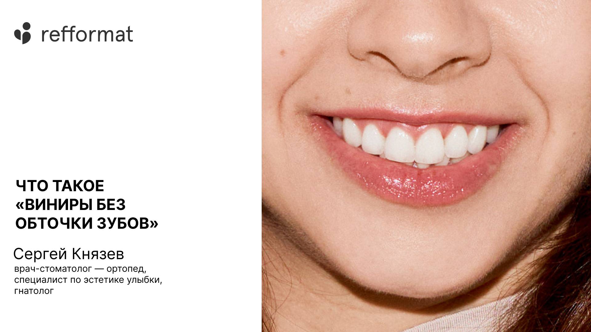 Что такое «виниры без обточки»?