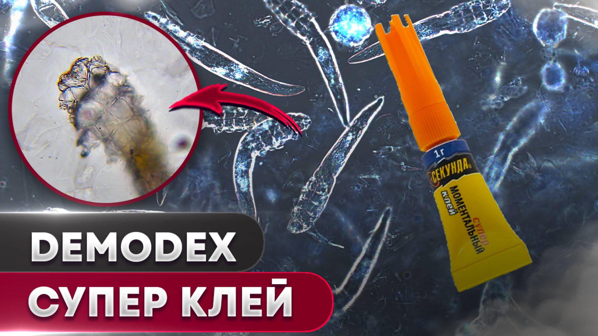 Супер клей против клеща | Угревая Железница Demodex