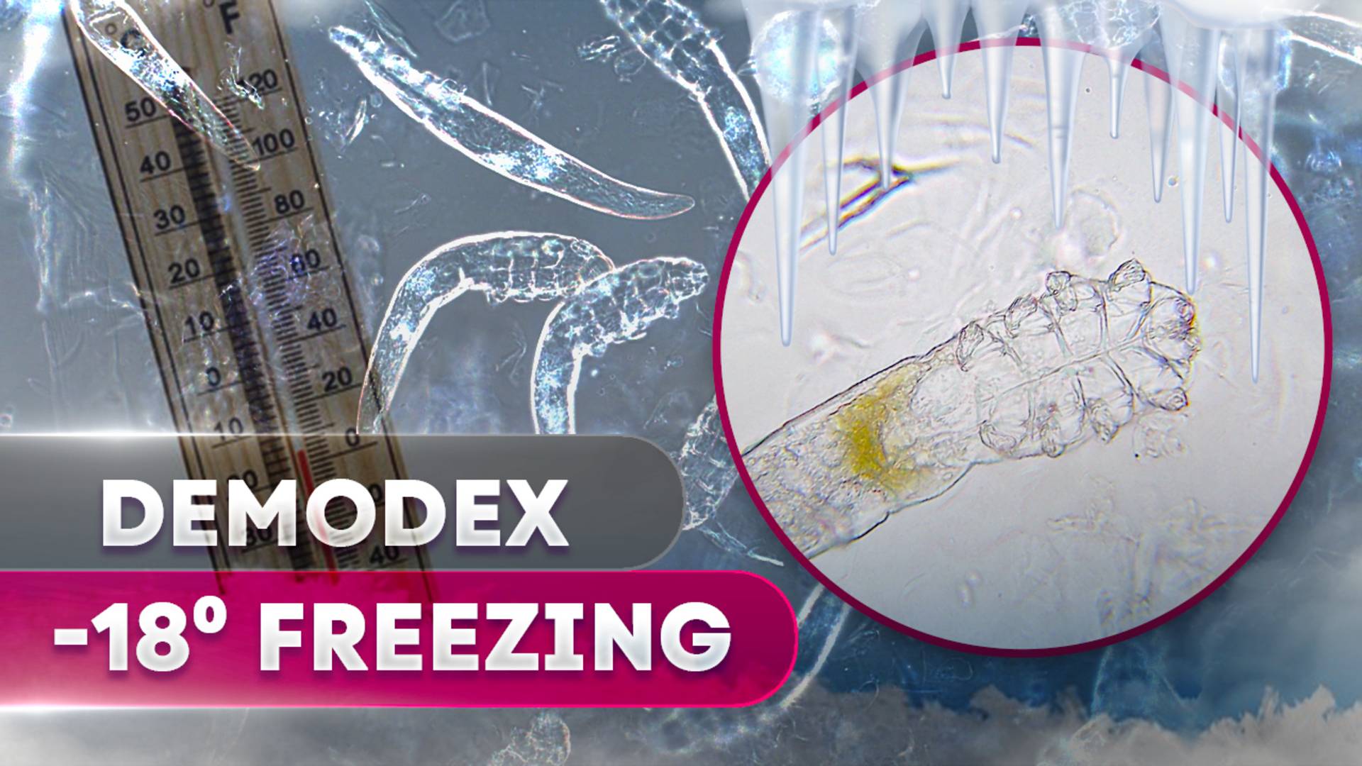 Мороз -18° против клеща | Угревая Железница Demodex