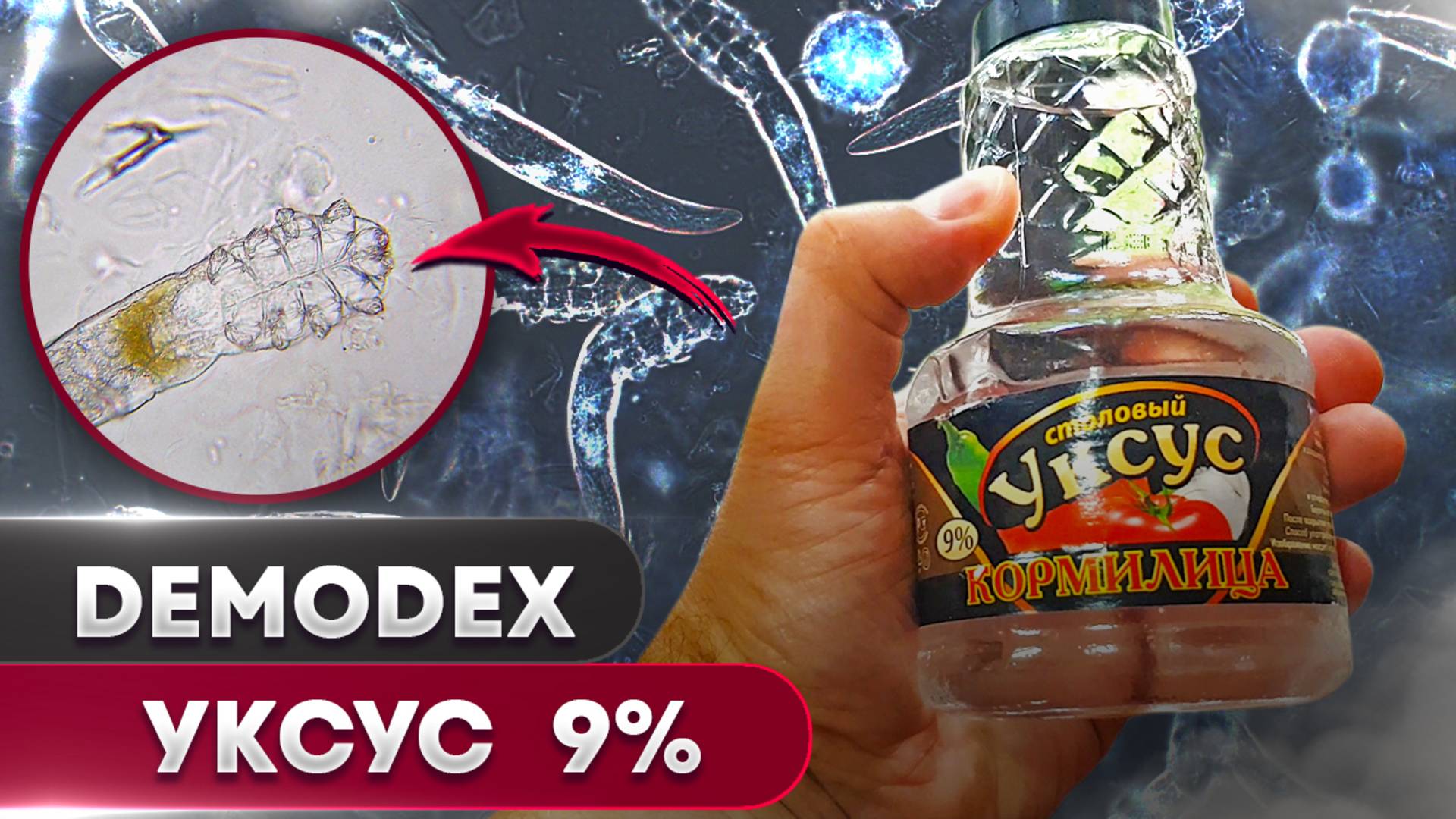 Уксус 9% против клеща | Угревая Железница Demodex
