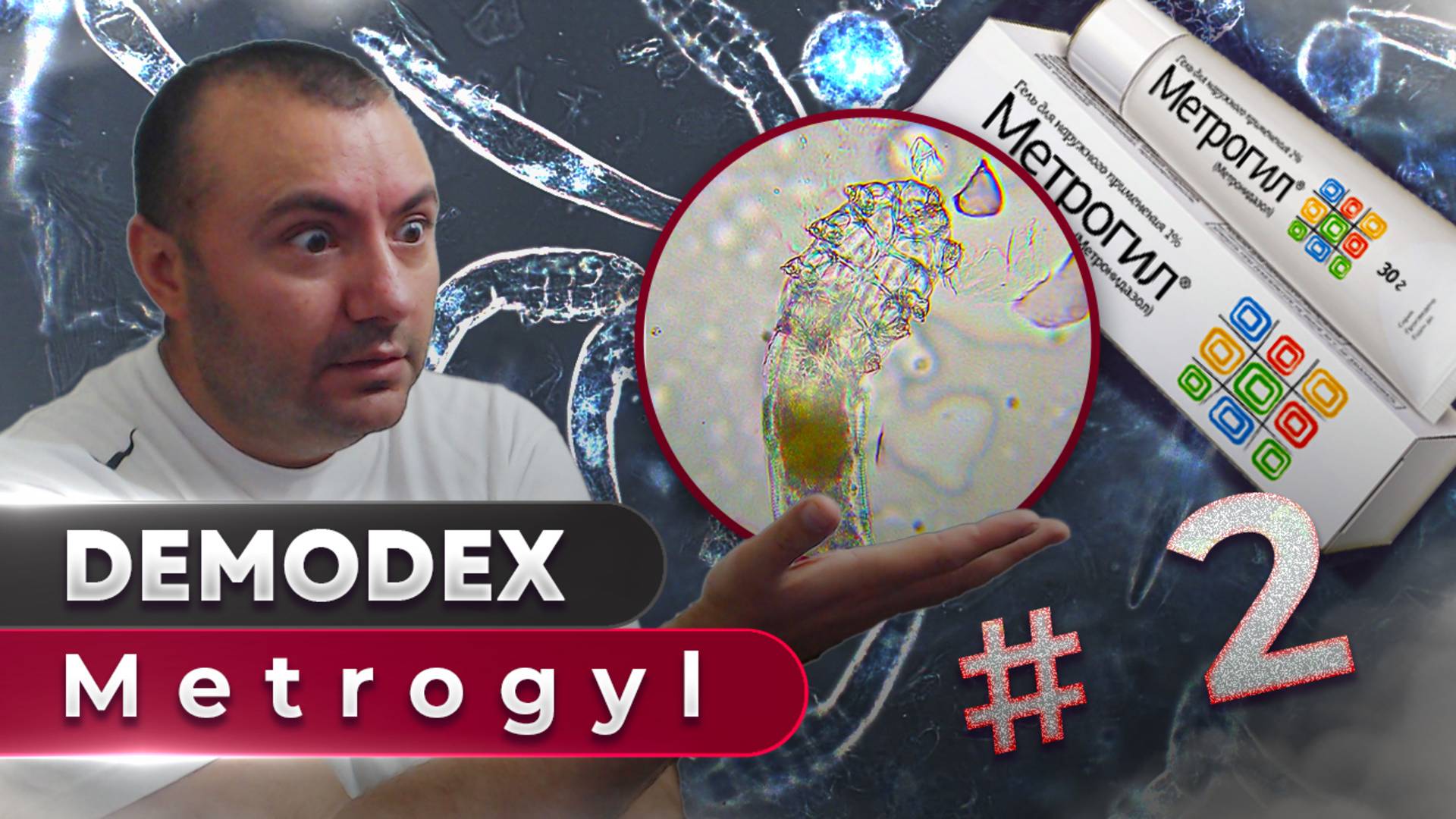 Метрогил против клеща | Угревая Железница Demodex #2