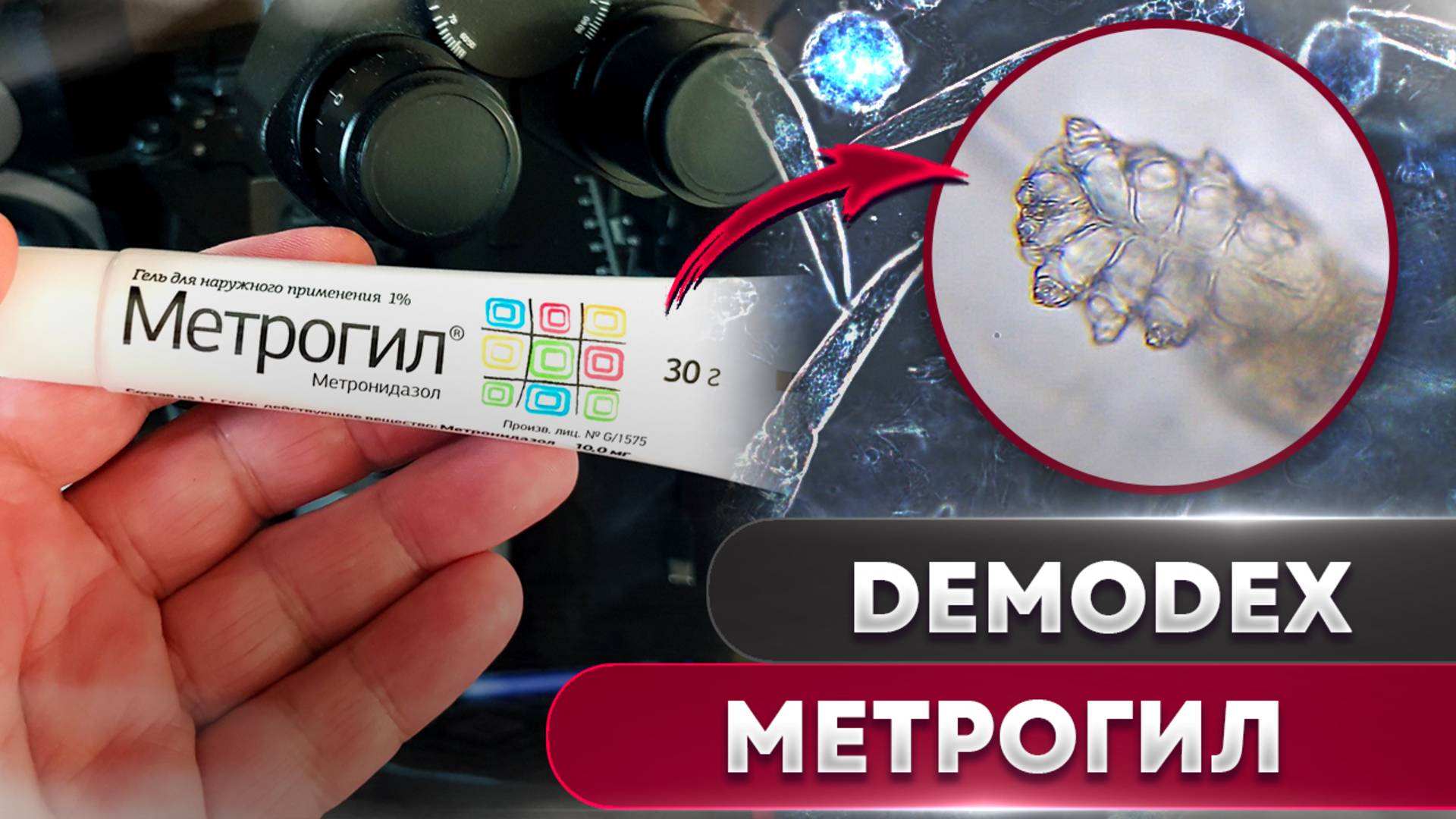 Метрогил против клеща | Угревая Железница Demodex # 1