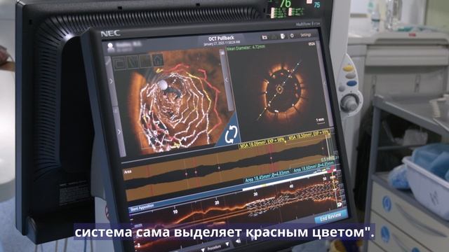 Оптическая когерентная томография