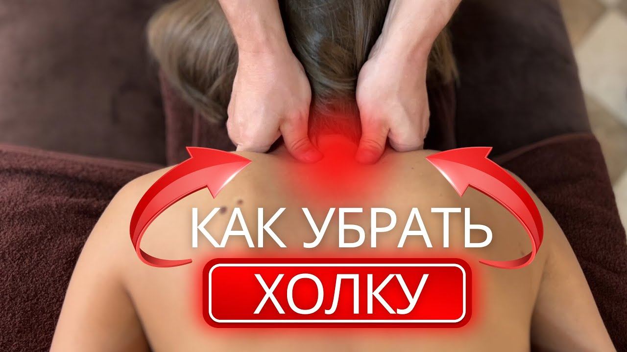 Вдовий ГОРБ | КАК ИЗБАВИТЬСЯ от холки на шее НАВСЕГДА