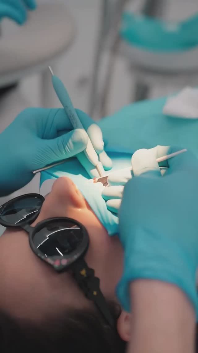 Лечение кариеса на передних скученных и наклоненных зубах