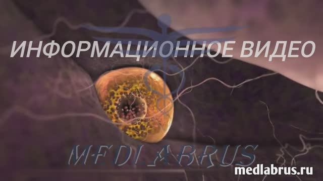 Овуляция – ключевой момент женского цикла