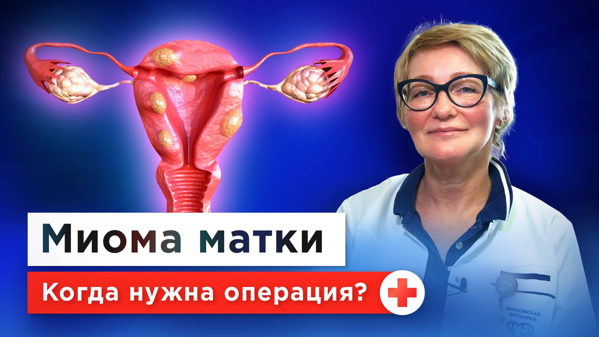 Всегда ли нужна операция при миоме матки? Гинеколог о причинах, симптомах и лечении