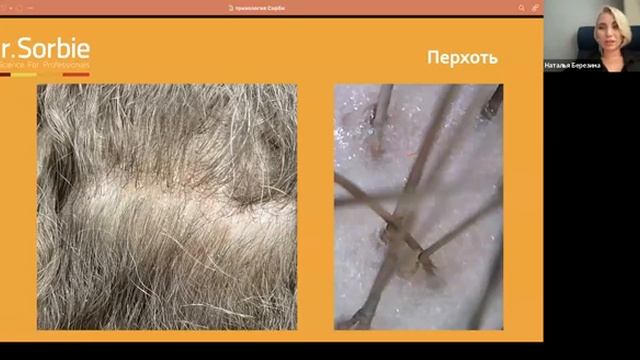 Трихологическая линия Dr.Sorbie